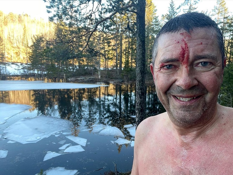 Apetor ยูทูบเบอร์ดัง เสียชีวิต เพียง 5 วัน หลังเพิ่งอัดคลิปบอกผมยังไม่ตาย